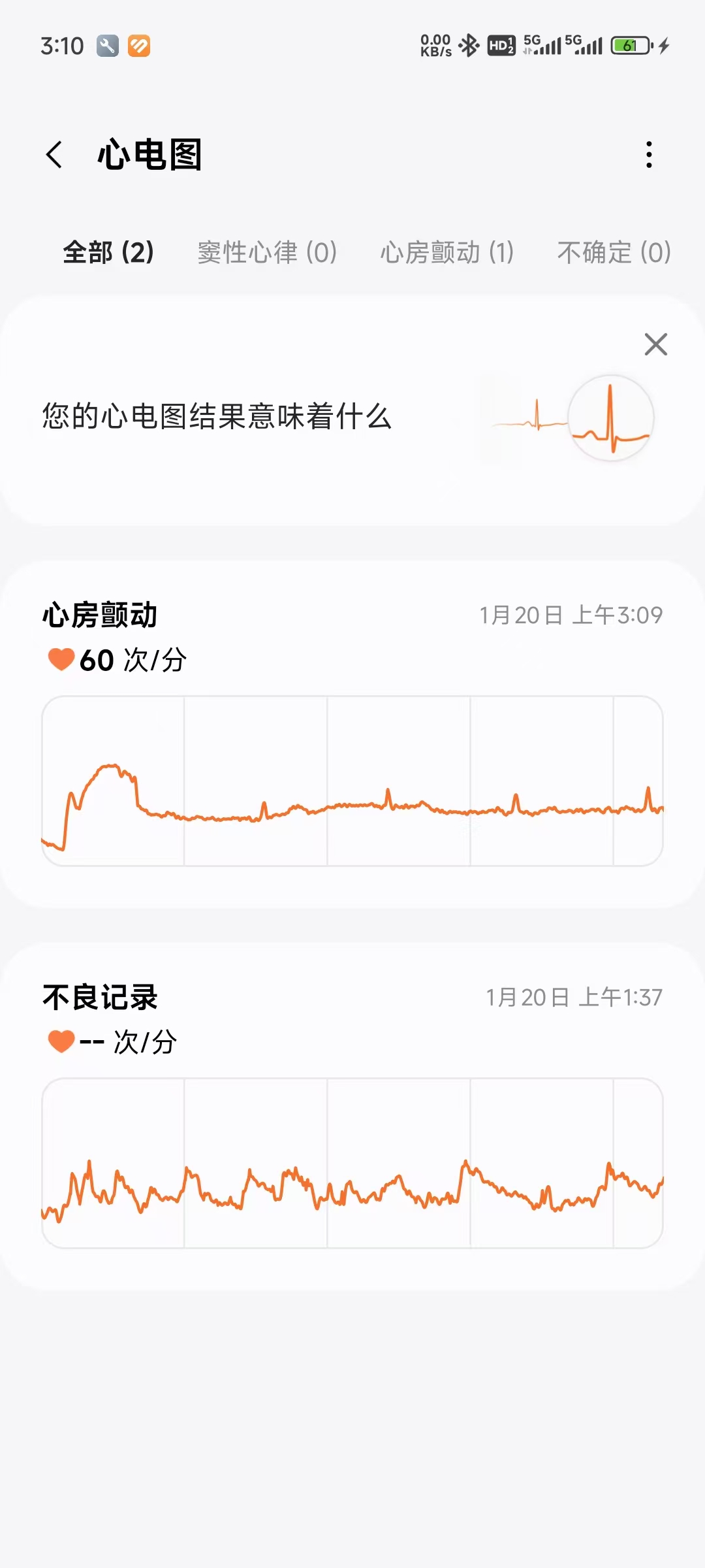 国行三星 Galaxy Watch7 其他品牌手机解锁心电图、血压等功能 – N25H